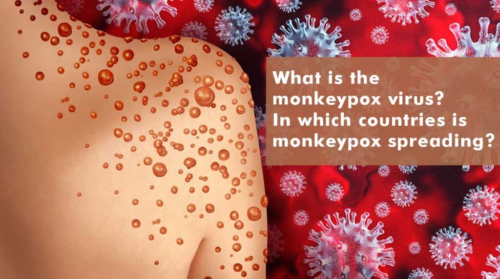 What is the monkeypox virus? In which countries is monkeypox spreading ...